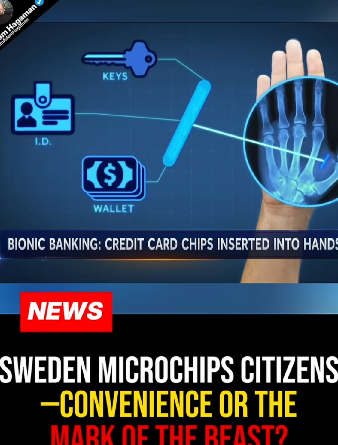 Would You Microchip Your Hand? Thousands of Swedes Already Have to ...